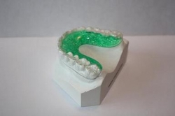 Clear Fusion Orthodontic Hybrid Retainers - PR.com